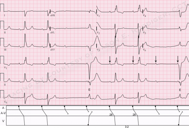 LPHB | ECG Guru - Instructor Resources LPHB | ECG Guru - Instructor Resources